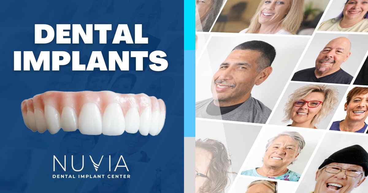 Nuvia Dental Implant Center | Dental Implants in 24Hrs